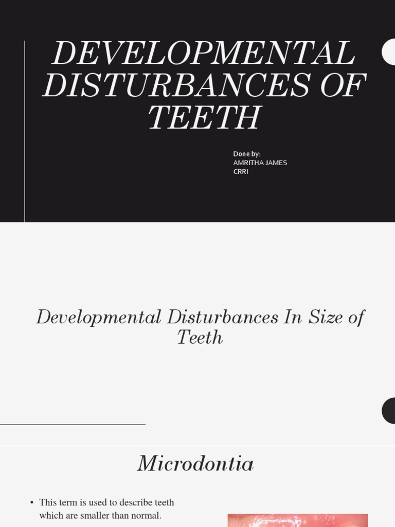 Developmental Disturbances of Teeth | PDF | Human Tooth | Tooth