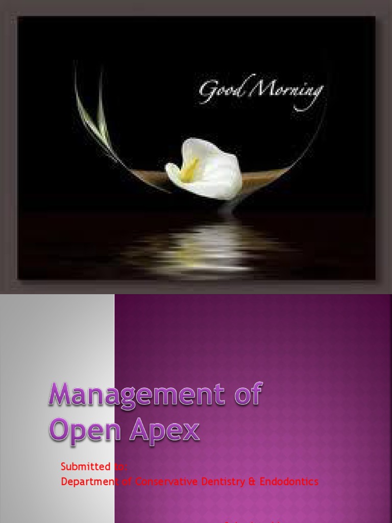 Management of Open Apex in Endodontics | PDF | Human Tooth | Mouth
