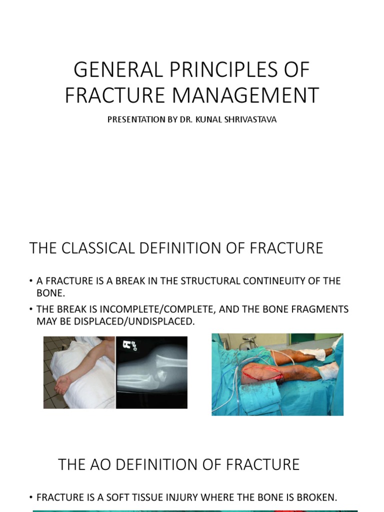General Principles of Fracture Management: Presentation by Dr. Kunal Shrivastava | PDF | Wound ...