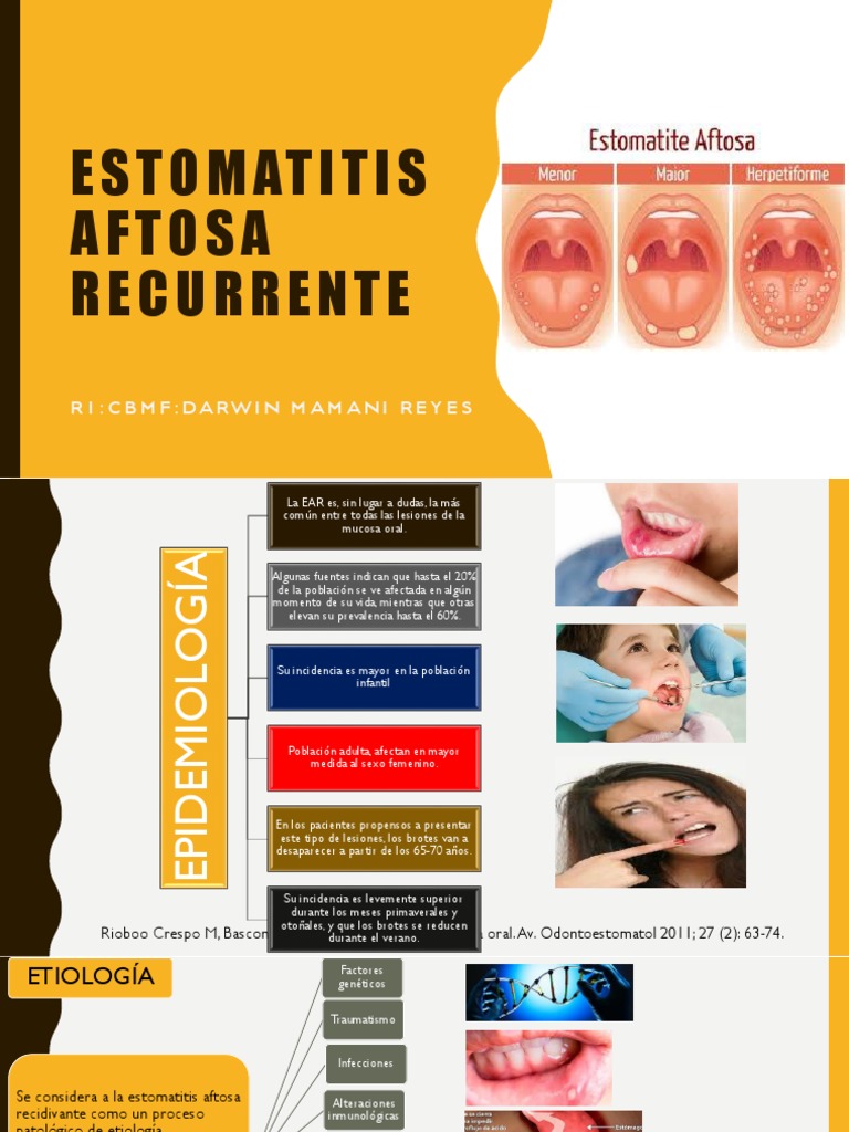 Estomatitis Aftosa Recurrente | PDF | Ciencias de la Salud ...