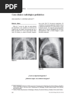 Grados de Cardiomegalia según ICT | PDF