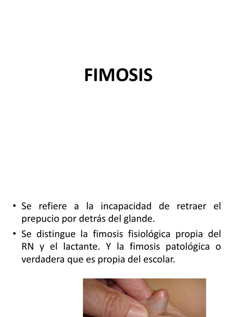 Fimosis | PDF | Especialidades Medicas | Medicina CLINICA