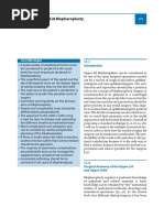 Lid Parallel Conjunctival Folds (LIPCOF) | PDF | Optics | Ophthalmology