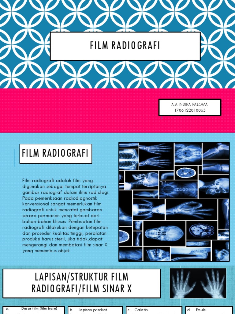 Film RADIOGRAFI | PDF