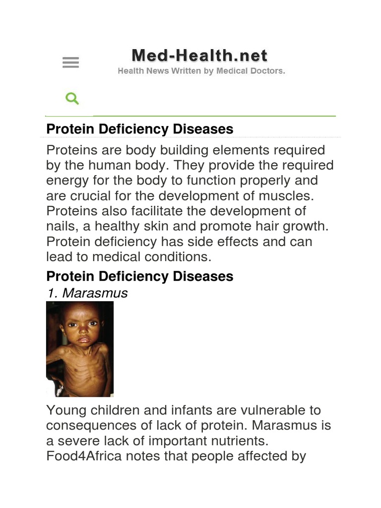 Symptoms of Deficiency of Protein | PDF | Foods | Malnutrition