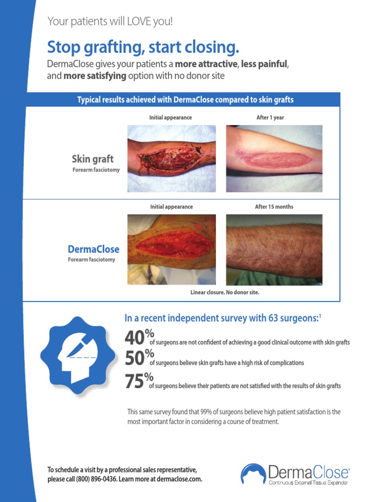 Skin Graft Vs DC 8DR | PDF | Surgery | Patient