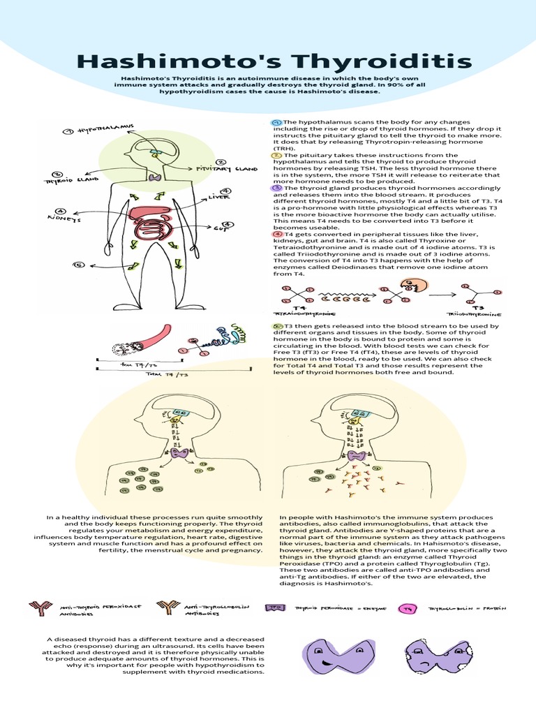 Hashimoto's Thyroiditis Infographic | PDF | Thyroid | Hypothyroidism