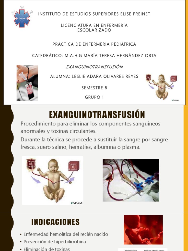 Ex Sanguine o Transfusion | PDF | El embarazo | Sangre