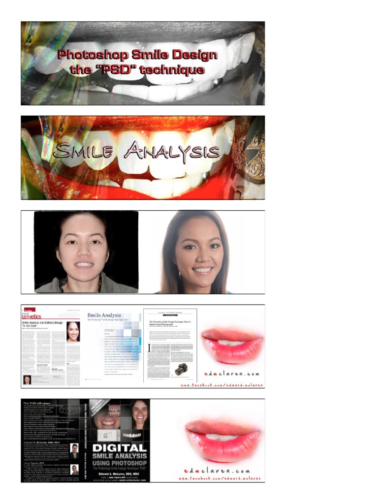 PSD Photoshop Smile Design | PDF