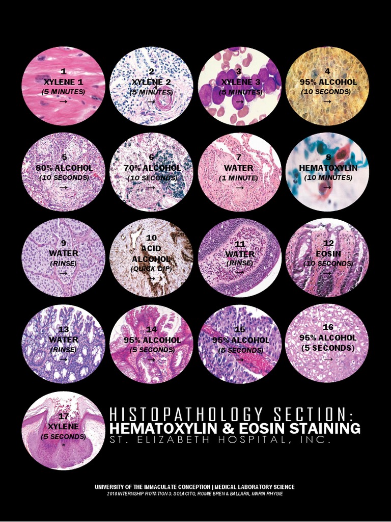 Hematoxylin and Eosin Procedure | PDF