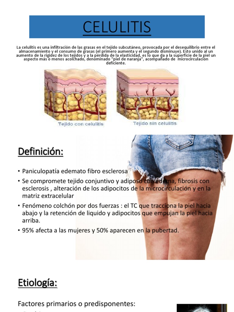 Celulitis | PDF | Tejido adiposo | Especialidades Medicas