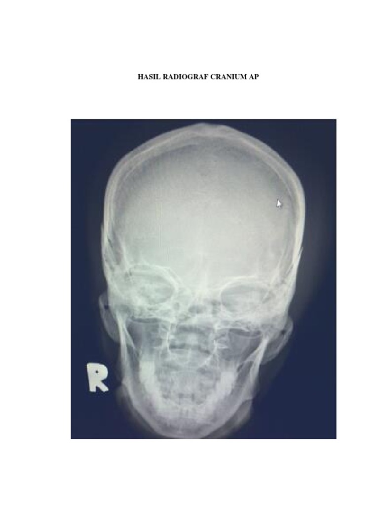 Kritisi Dan Evaluasi Cranium Ap - Kelompok 5 | PDF