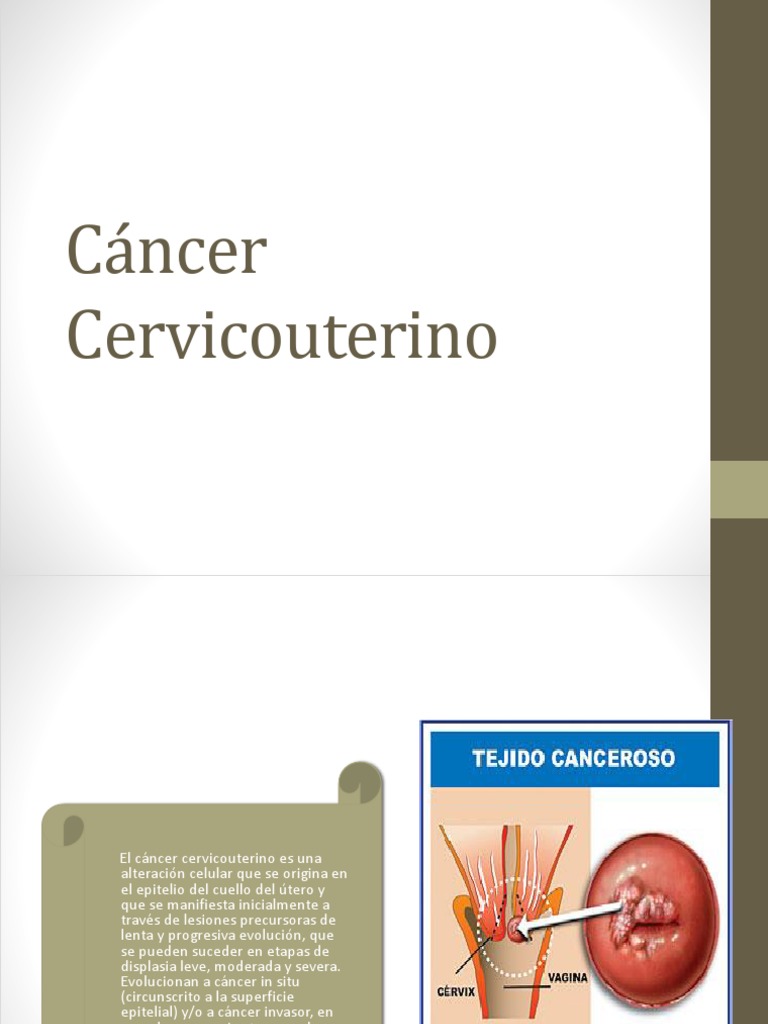 Cancer Cervicouterino | PDF | Cáncer de cuello uterino | Cáncer