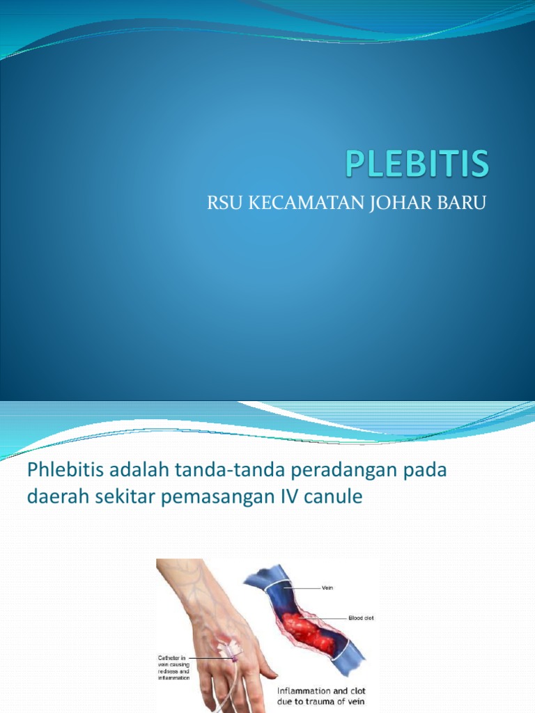 PLEBITIS | PDF