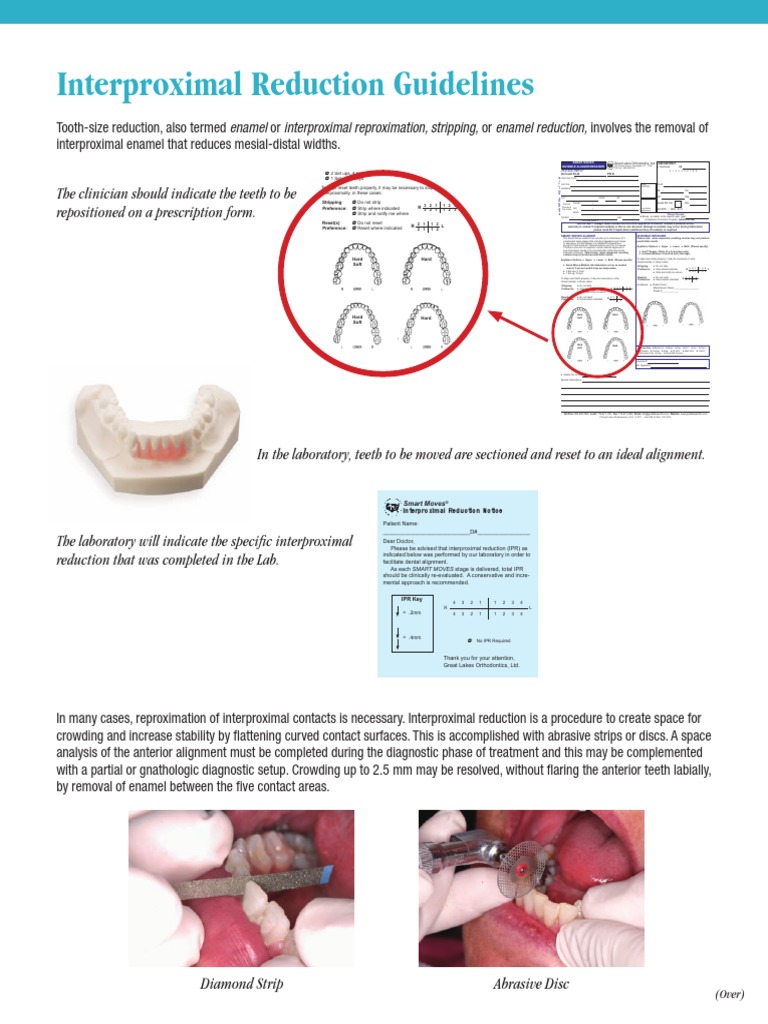 InterproximalReductionGuidelines S364 | PDF | Orthodontics | Tooth Enamel