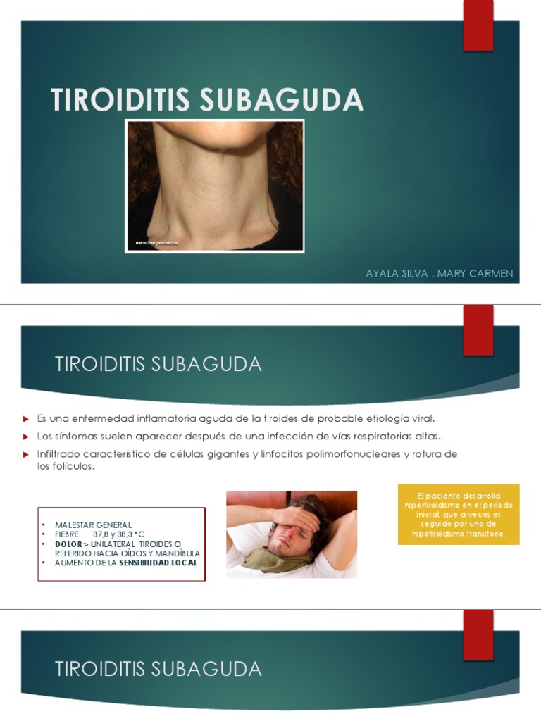 Tiroiditis Subaguda | PDF | Tiroides | Hormona estimulante de la tiroides