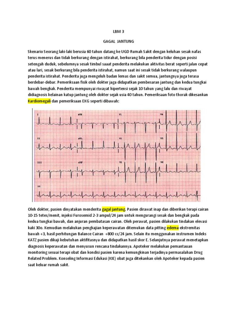 Li SGD 1 LBM 3 Ipe | PDF
