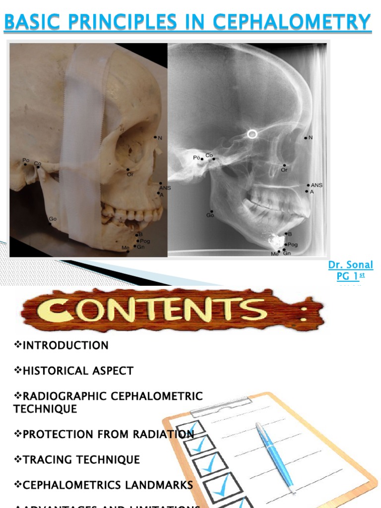 Basic Principle in Ceph | PDF | Radiography | Skull