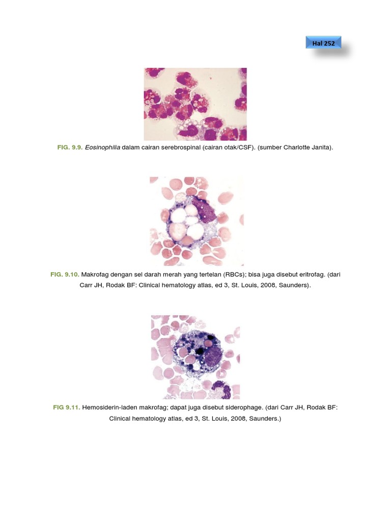 Translate Urinalisa Hal 252-253 | PDF | Sains & Matematika