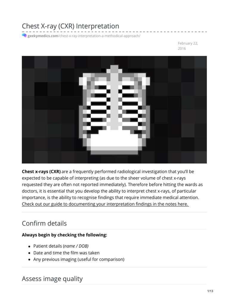 Chest X-ray Interpretation Methodical Approach | PDF | Lung | Heart