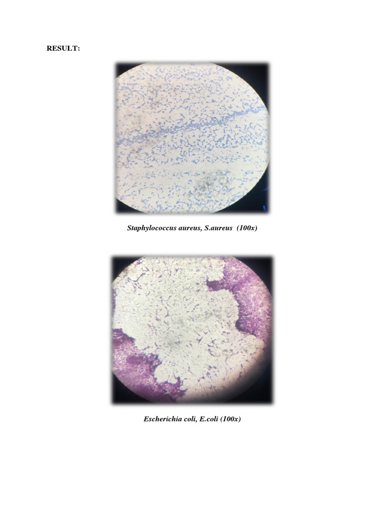Result:: Staphylococcus Aureus, S.aureus (100x) | PDF | Gram Positive ...