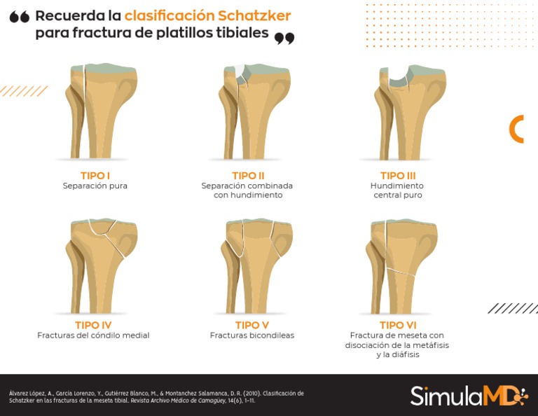 Clasificación de Schatzker en Fracturas Tibiales | PDF