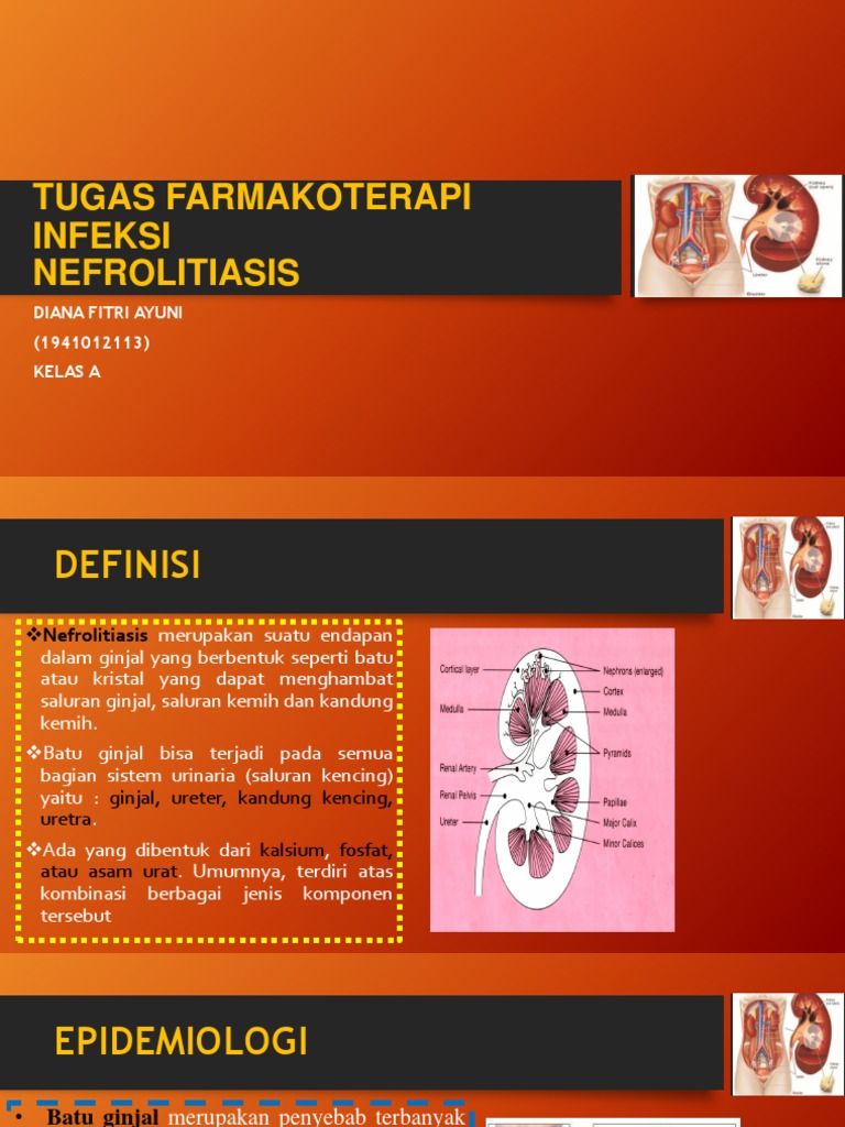 Nefrolitiasis | PDF