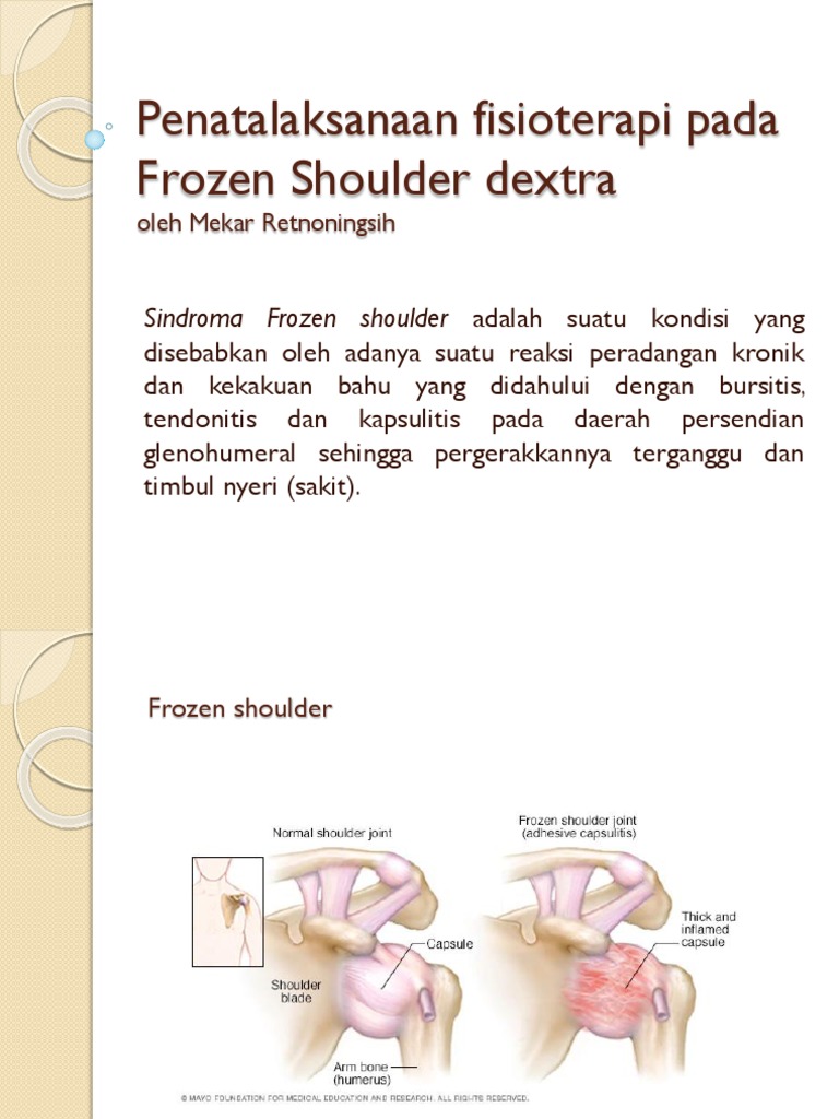 Fisioterapi Frozen Shoulder Kanan | PDF