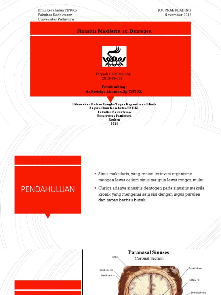 Sinusitis Maxilaris Dentogen | PDF