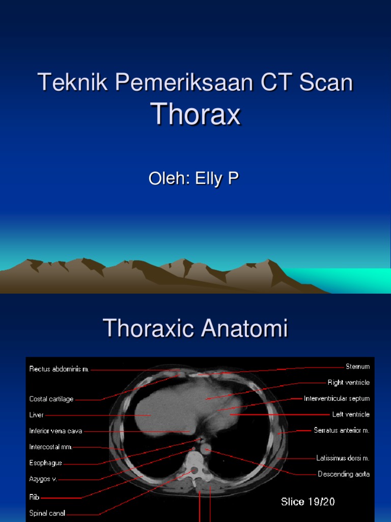 CT Scan Thorax Techniques Guide | PDF | Ct Scan | Lung