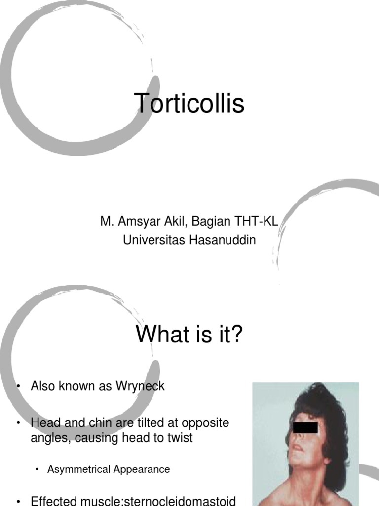 Torikolis | PDF | Medical Specialties | Medicine