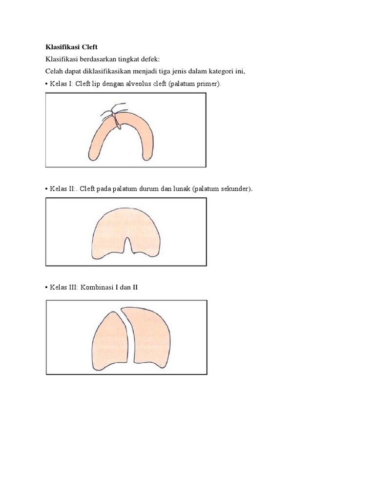 Klasifikasi Defek Maksila dan Palatum | PDF | Sains & Matematika
