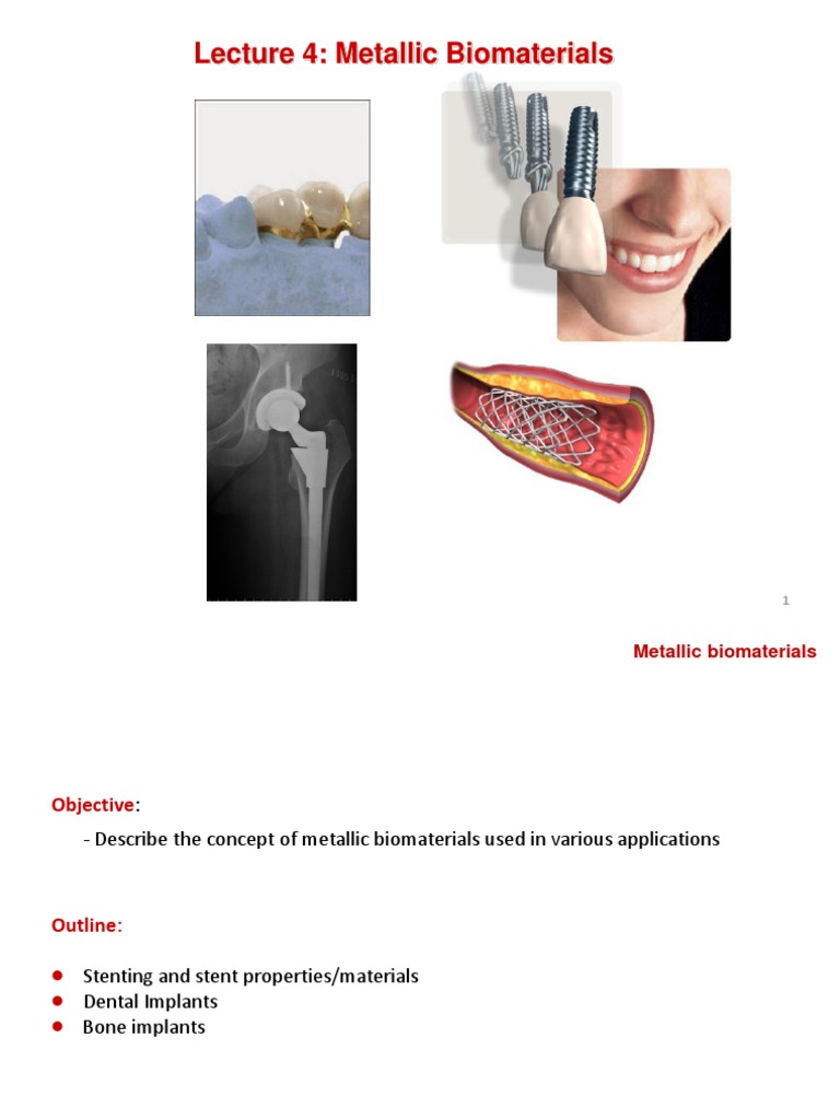 Metallic Biomaterials in Implants | PDF | Titanium | Dental Implant
