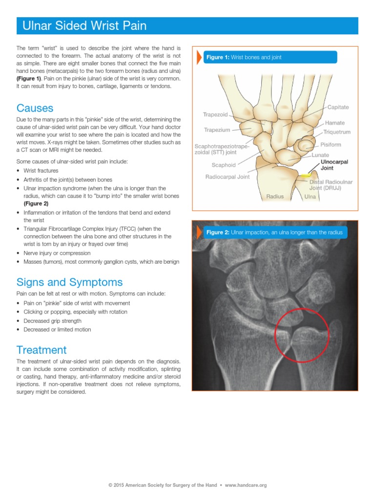 Ulnar Sided Wrist Pain | PDF