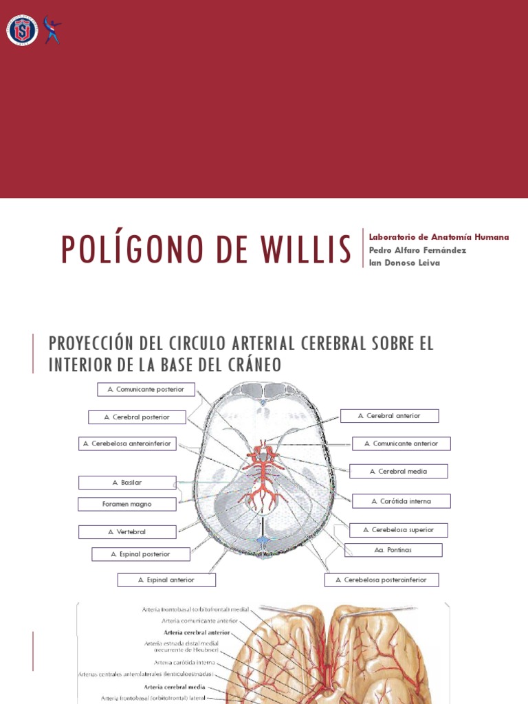Polígono de Willis | PDF | Lóbulo temporal | Arteria carótida común