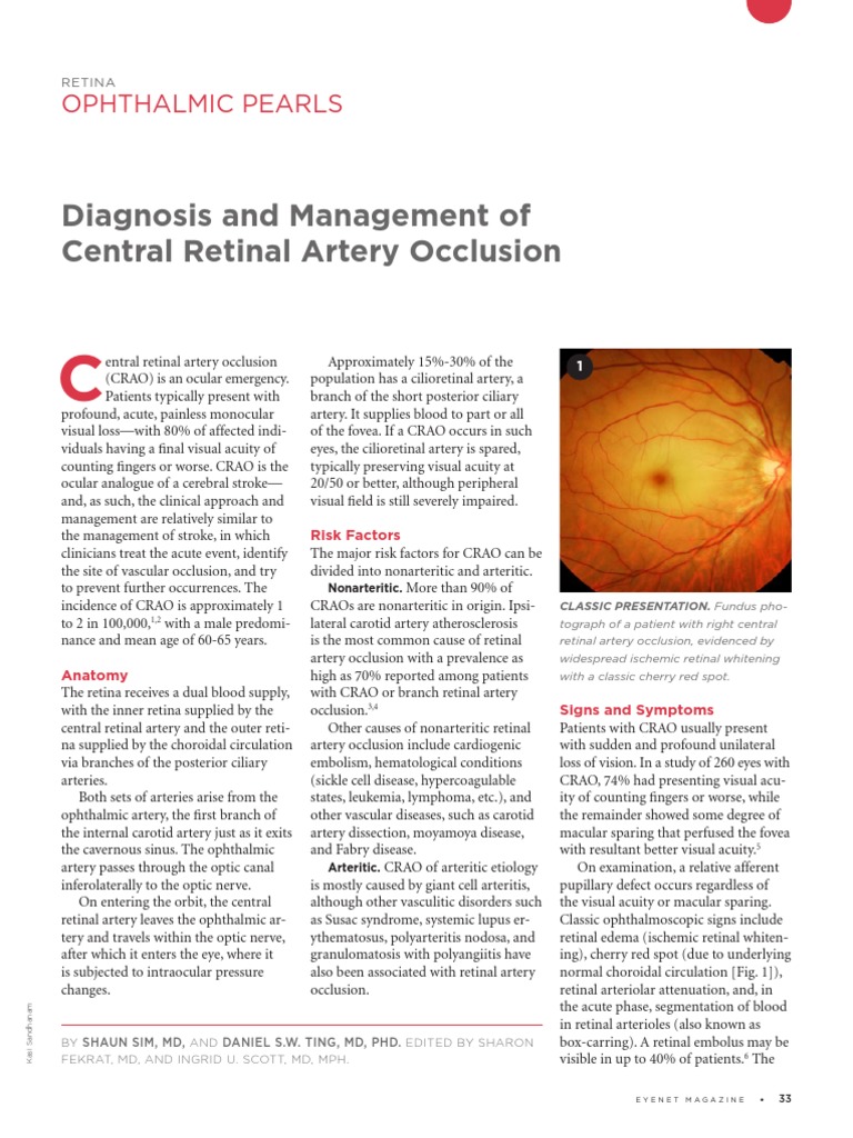 Management of CRAO | PDF | Stroke | Retina