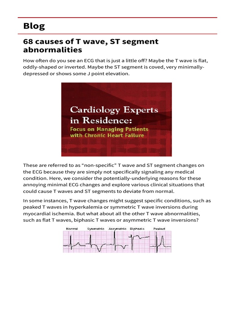 68 Causes of T Wave ST Segment Abnormalities | PDF ...