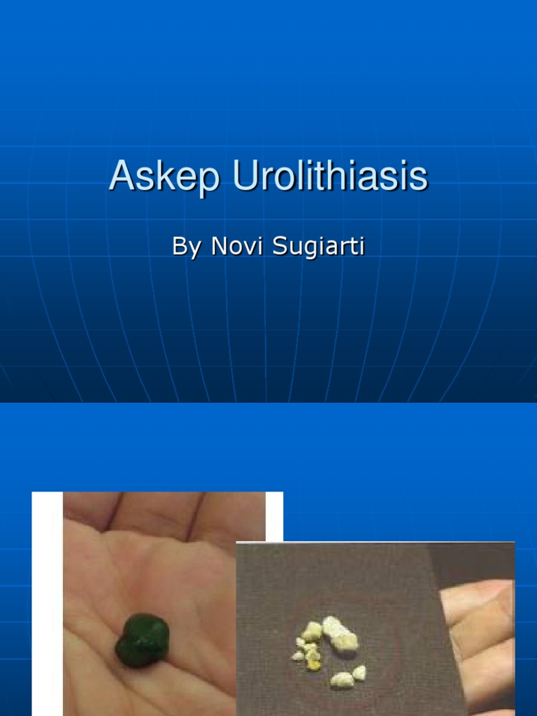 Askep Urolithiasis | PDF