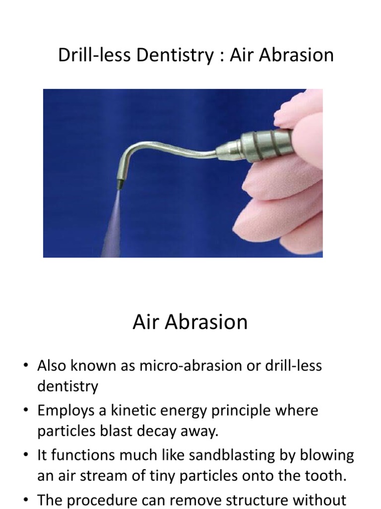 Drill-Less Dentistry: Air Abrasion | PDF