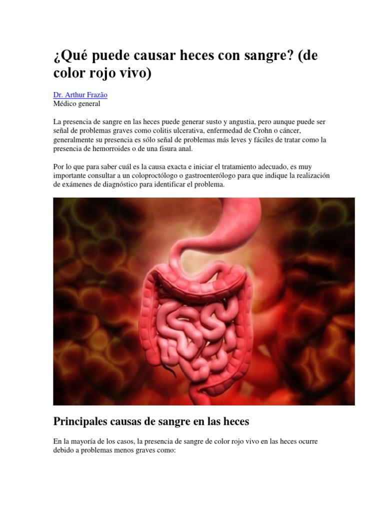 Qué Puede Causar Heces Con Sangre | PDF | Heces | Hemorroides
