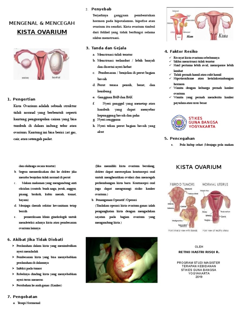 Kista Ovarium | PDF