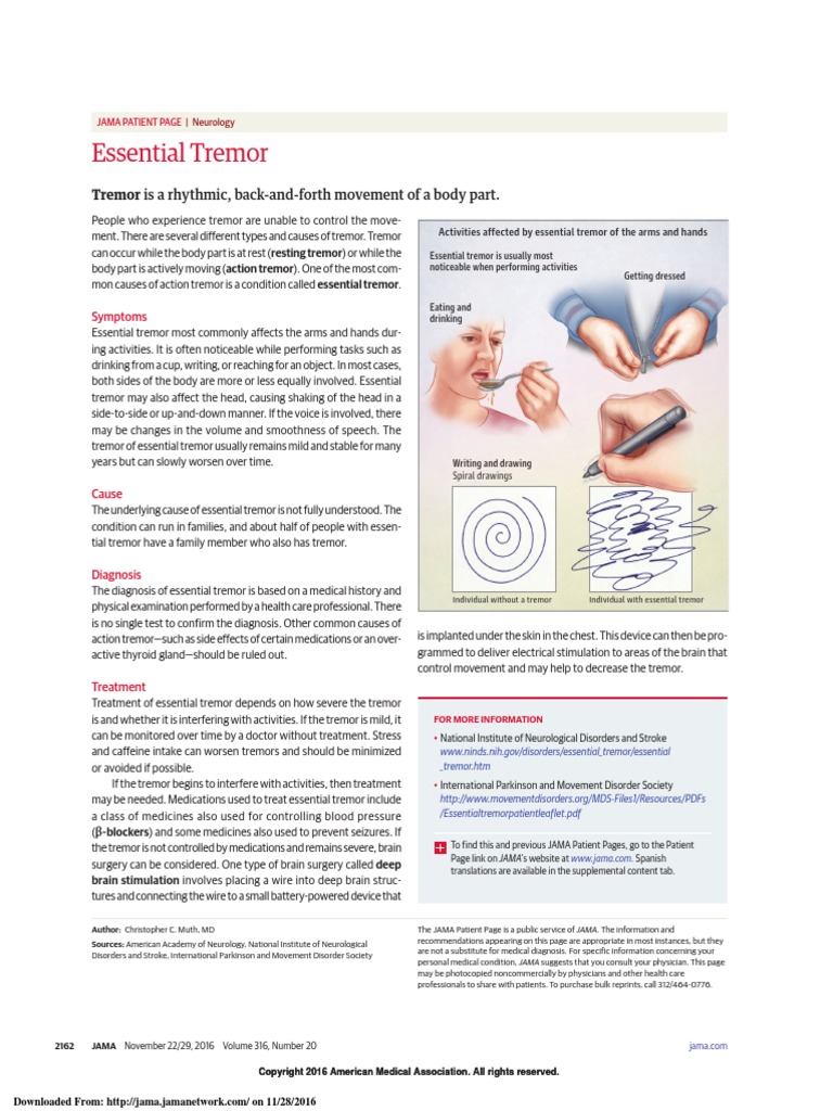 Essential Tremor: Is A Rhythmic, Back-And-Forth Movement of A Body Part ...