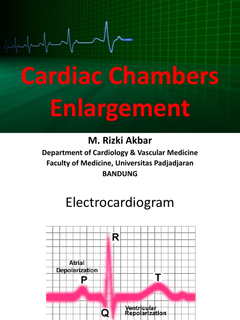 EKG Abnormal 1 - Unisba | PDF | Electrocardiography | Cardiac ...