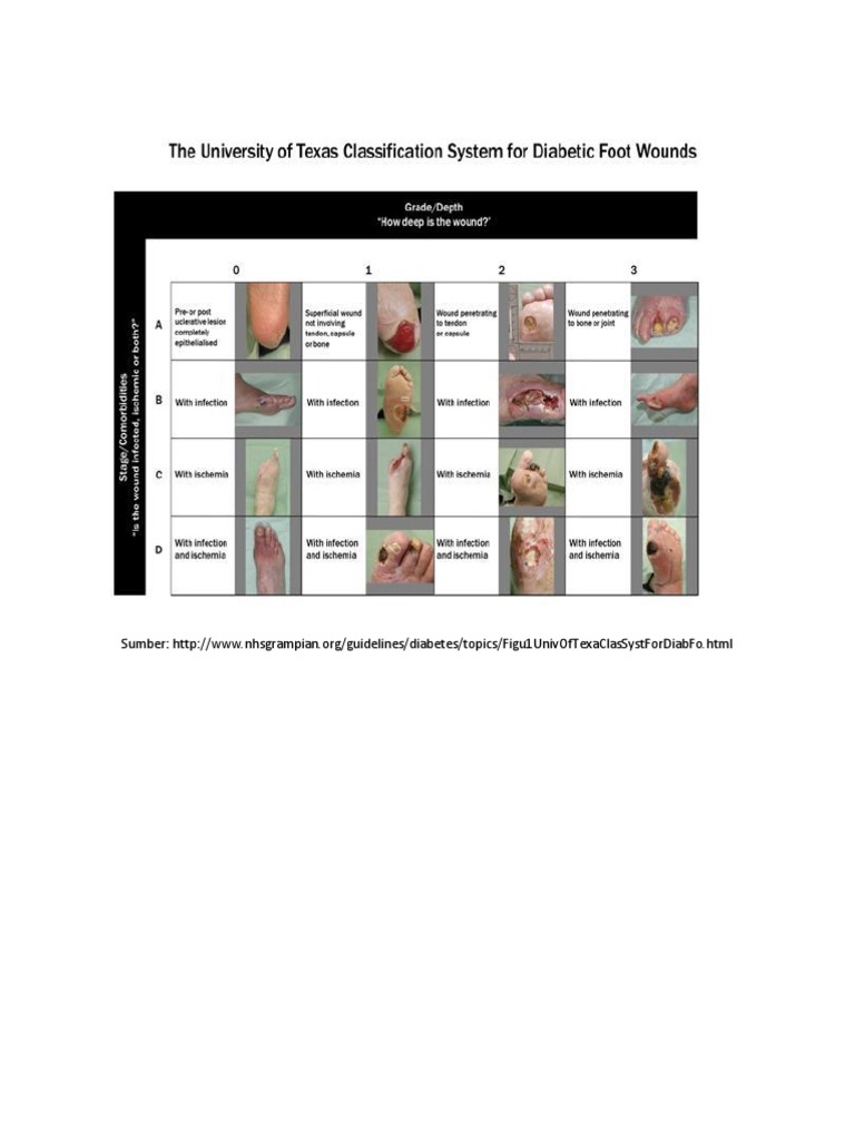 TEXAS Classification