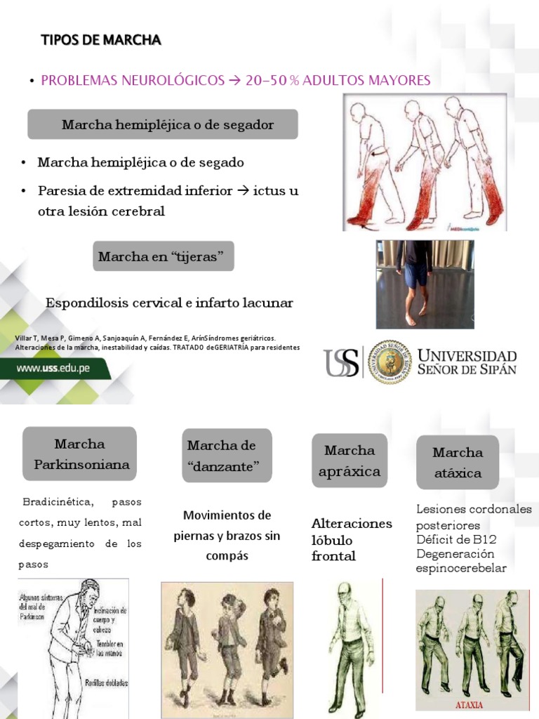 Tipos de Marcha | PDF | Causas de la muerte | Sistema nervioso