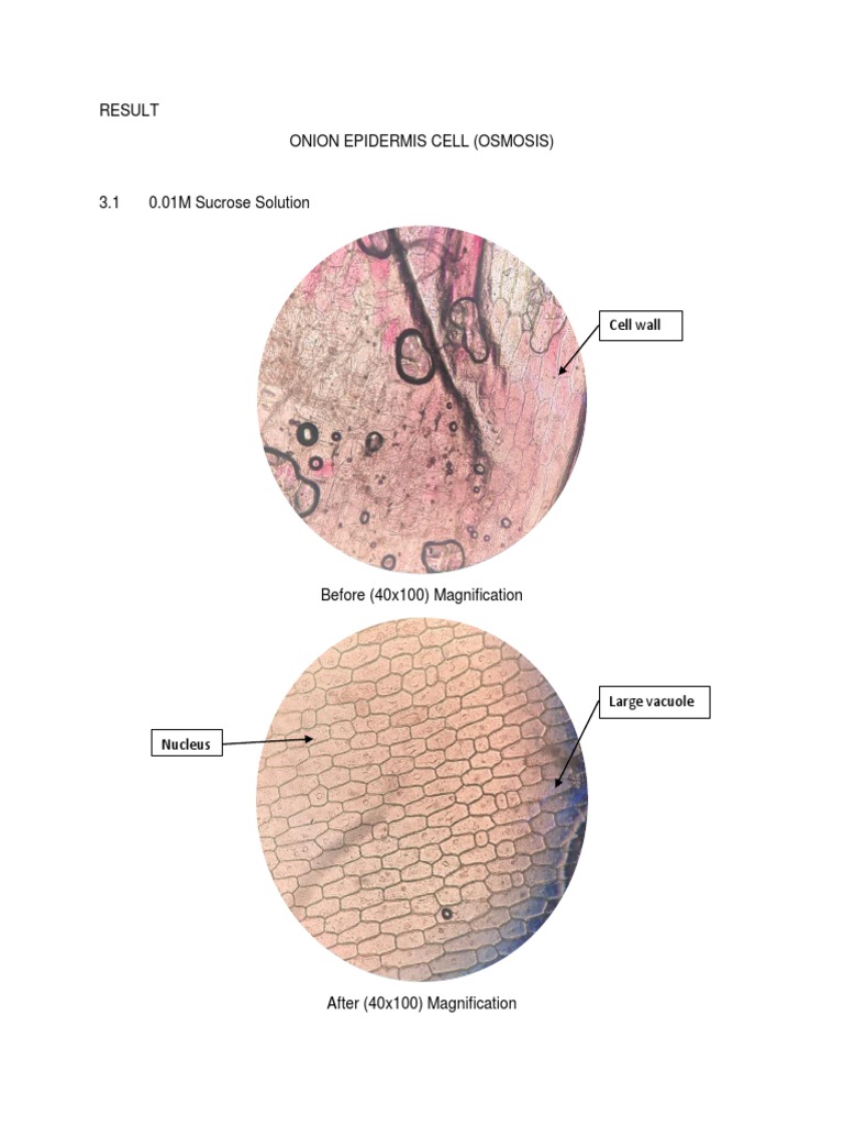Lab Cell Biology Onion | PDF | Osmosis | Biology