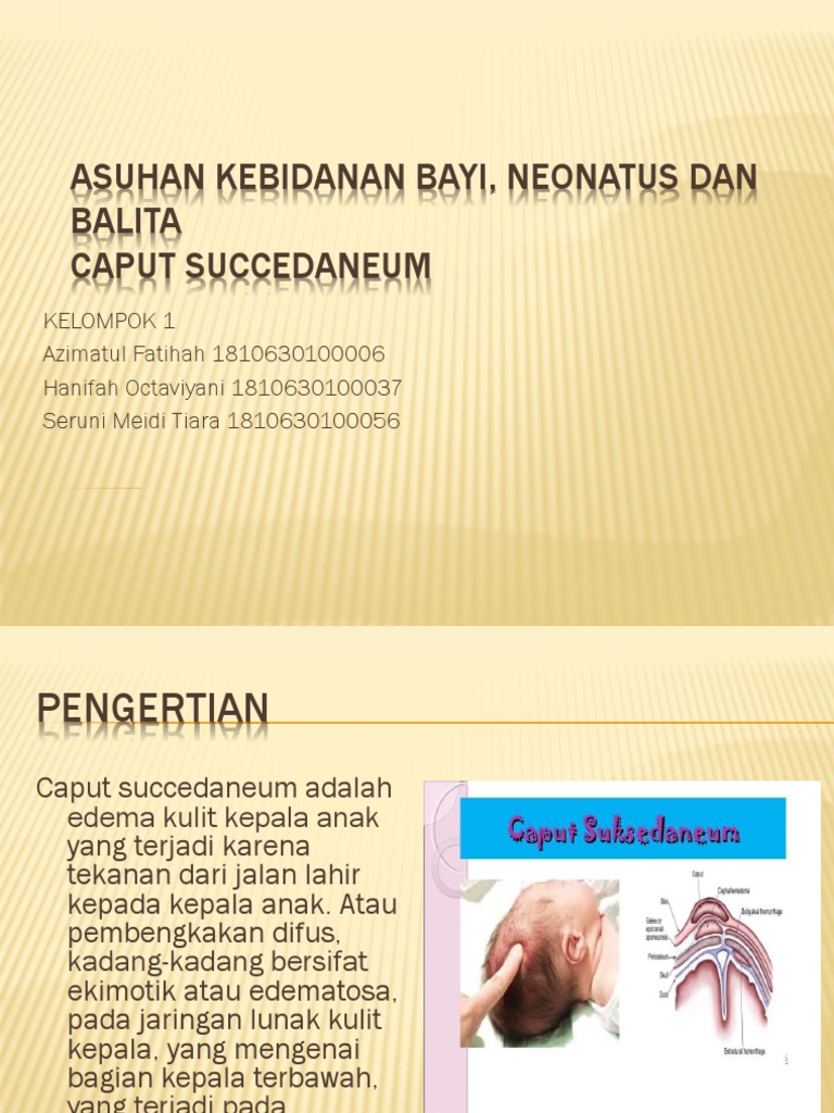 Penanganan Caput Succedaneum pada Bayi | PDF
