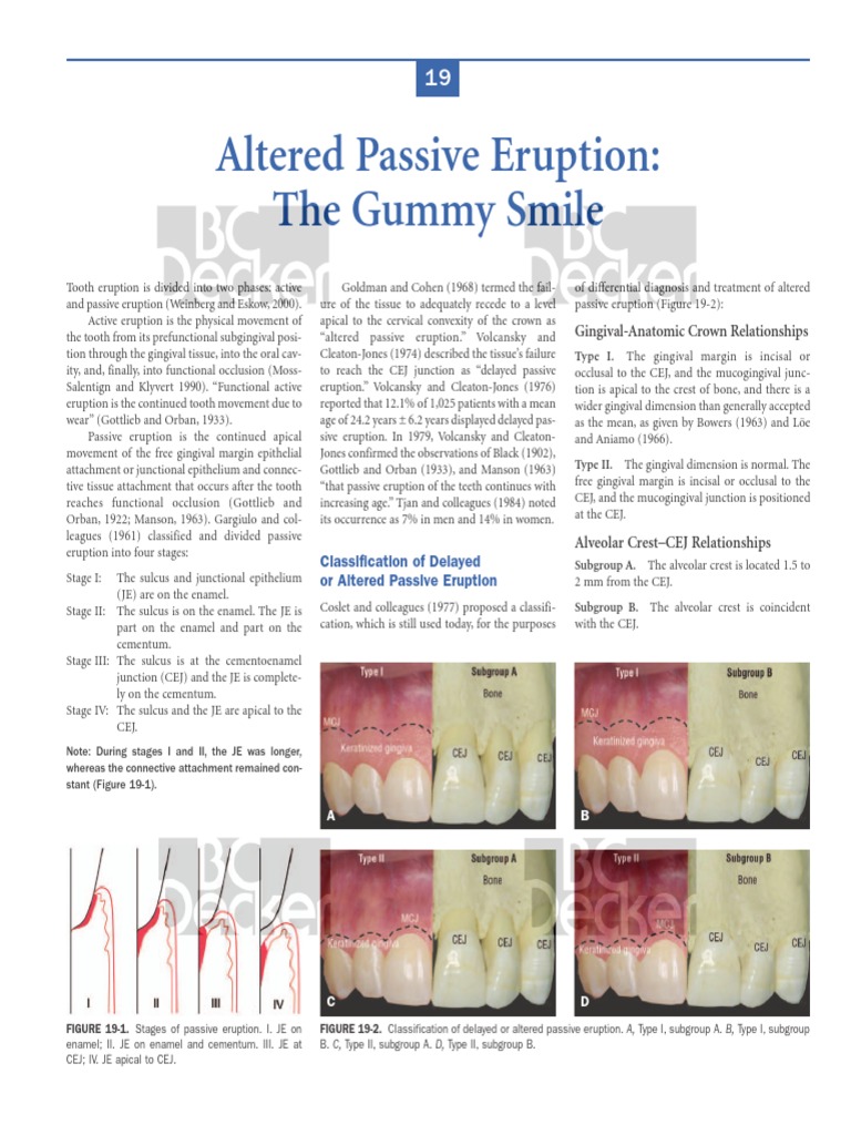 Altered Passive Eruption, The Gummy Smile | PDF | Medical Specialties ...
