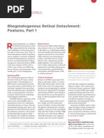 Understanding White Without Pressure (WWOP) | PDF | Vision | Ophthalmology