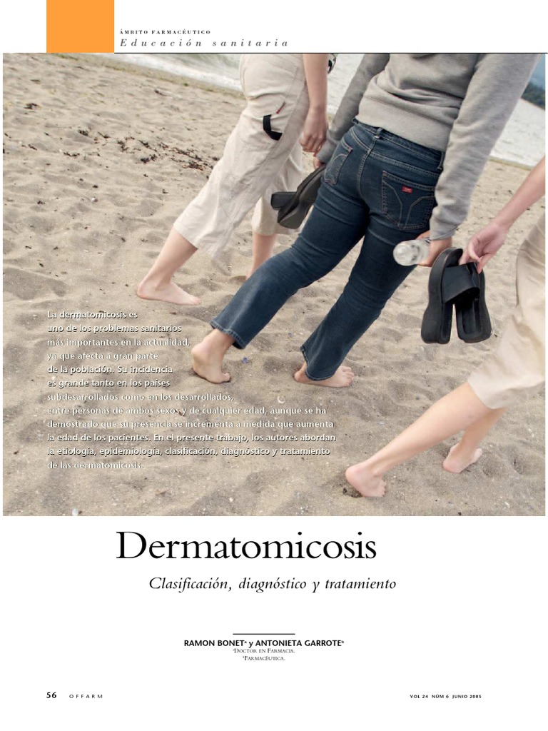 Tratamiento y diagnóstico de dermatomicosis | PDF | Medicina CLINICA ...